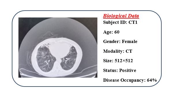 SITCOV- A bench mark database for COVID Analysis - Sethu Institute of Technology