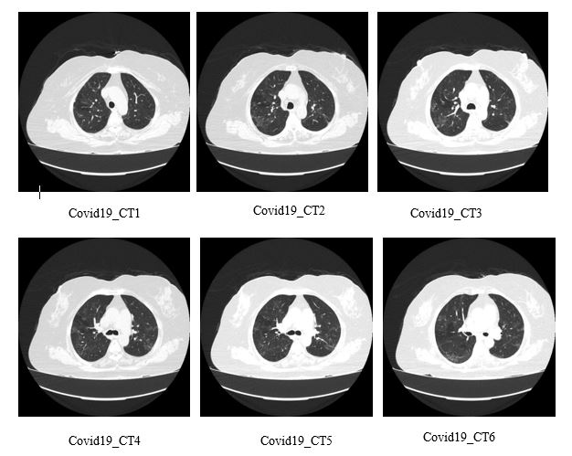 SITCOV- A bench mark database for COVID Analysis - Sethu Institute of Technology